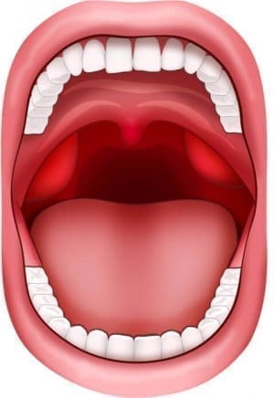 Amygdalite : le guide complet | ORAVIX