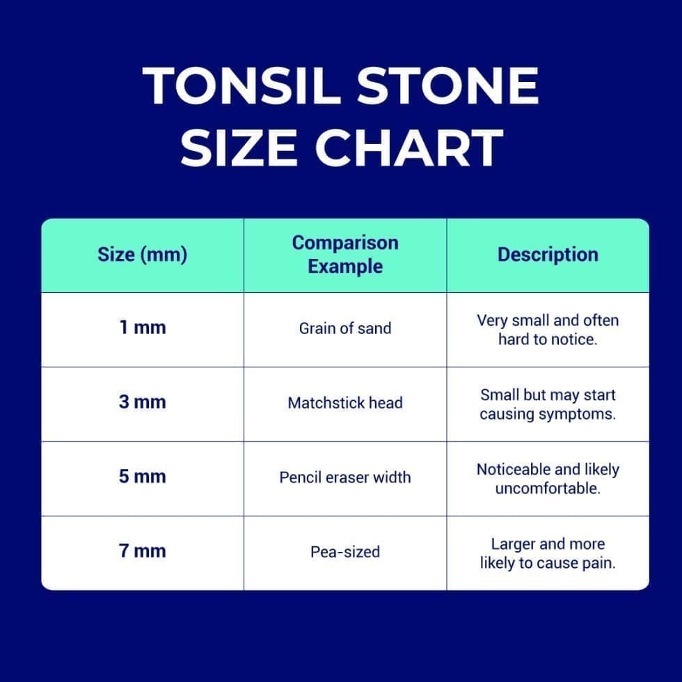 What Are Tonsil Stones? Causes, Signs and Prevention