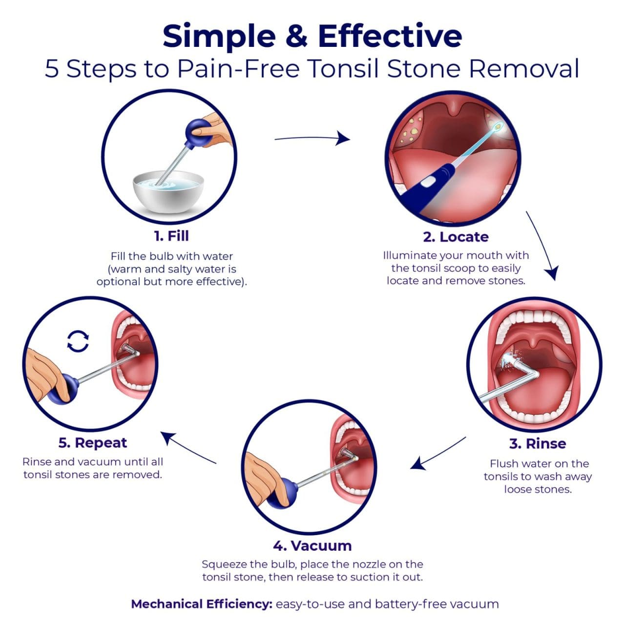 Tonsil Stone Vacuum | ORAVIX